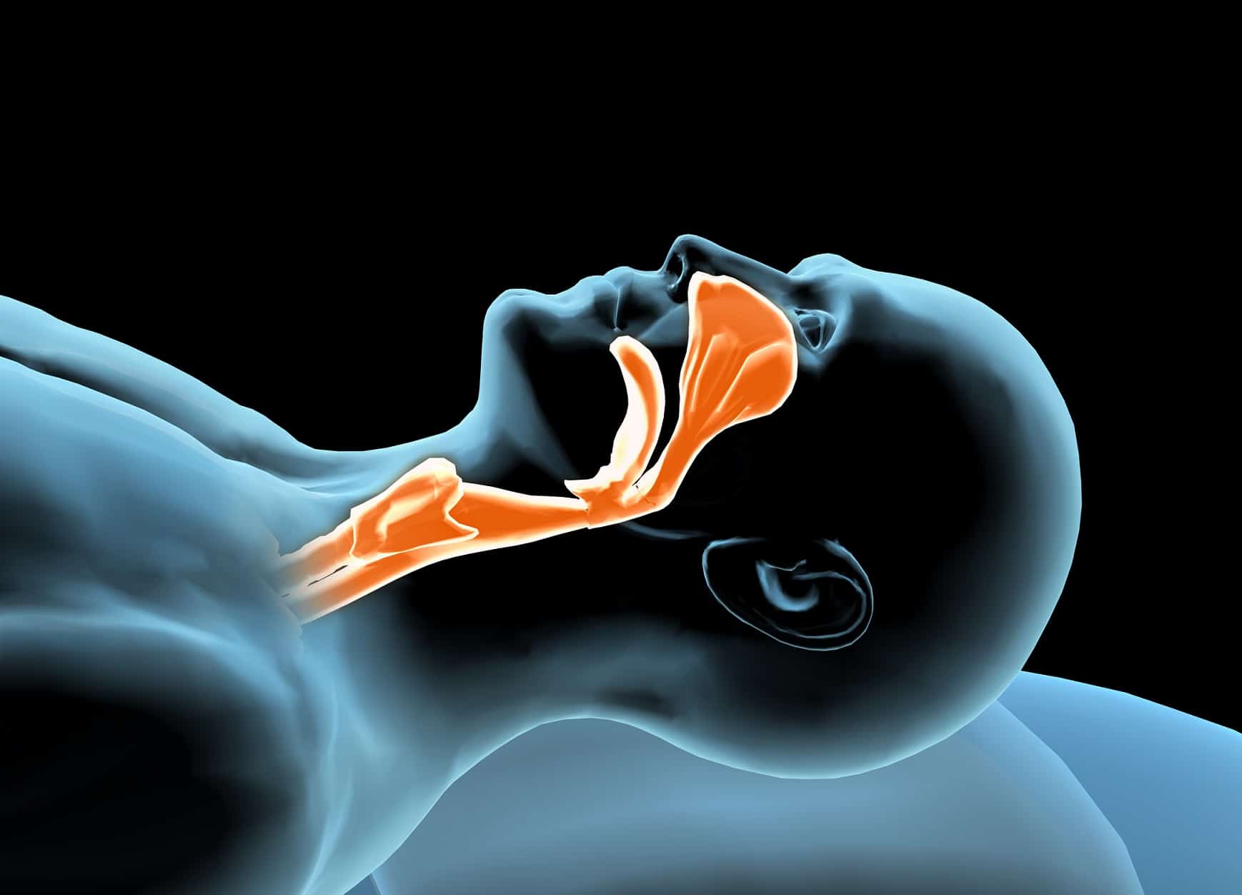 What Makes Snoring a Problem for Your Sleep? | Conroe, TX