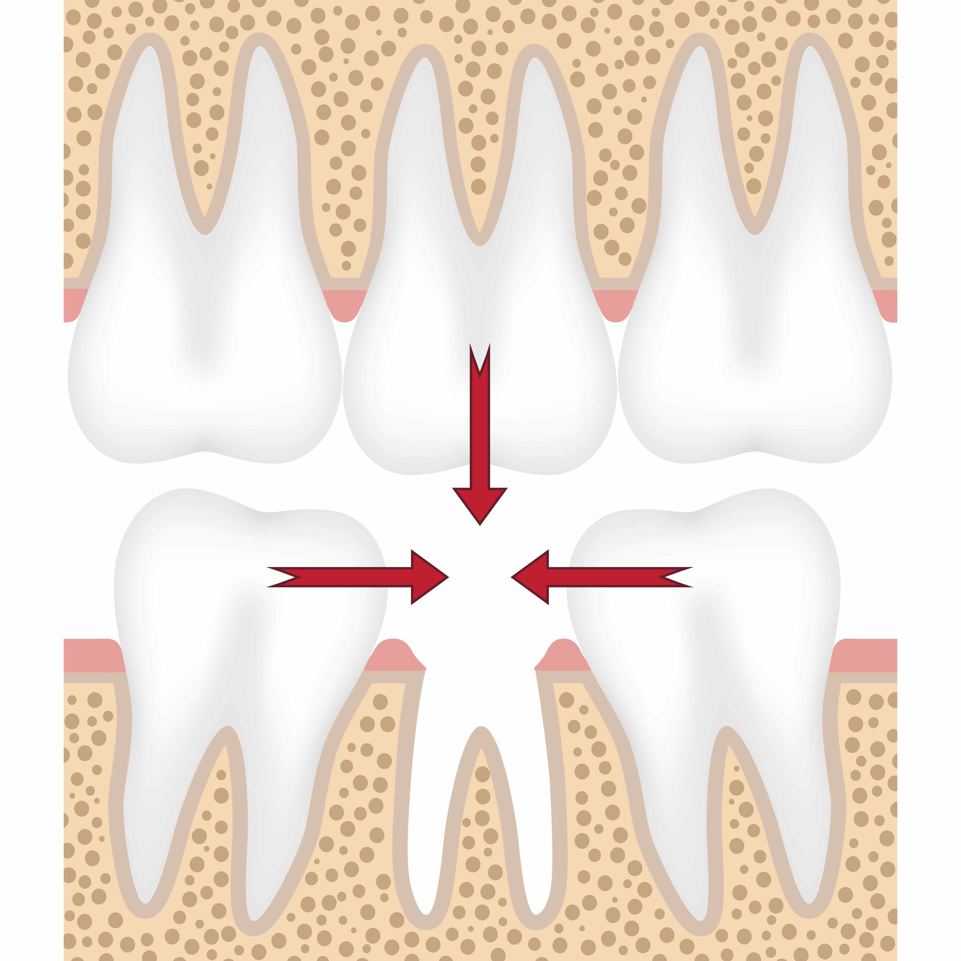 Replacing Lost Teeth to Restore Function | Conroe, TX